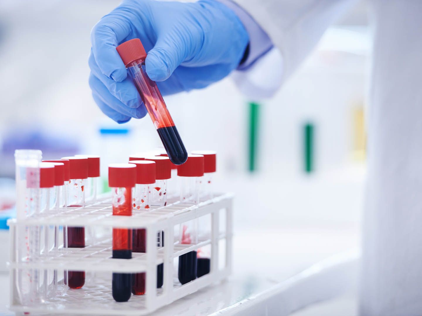 Target Pathology Laboratory – Fast, Accurate and Reliable Pathology